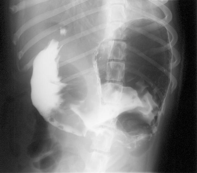 worka/vanilla-js-wheel-zoom