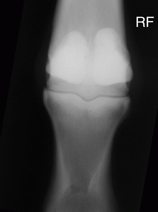 worka/vanilla-js-wheel-zoom